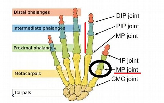 סד דינאמי ליישור אצבע- Reverse Finger Knuckle Bender | אצבעות וכף יד ...
